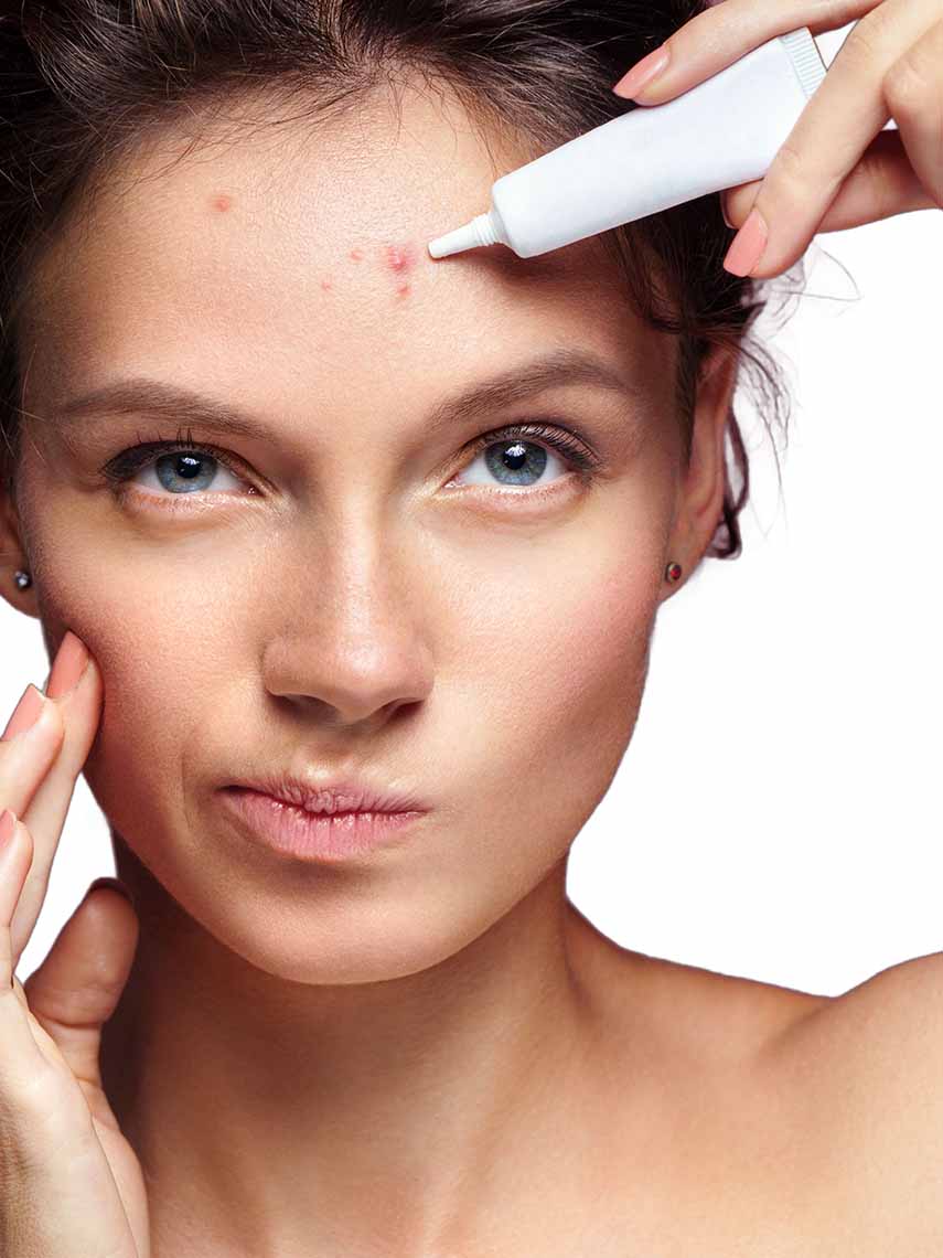 Traitement acné laser / IPL Nordskin | RIVIERAclinic